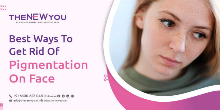 Best Ways To Get Rid Of Pigmentation On Face - TheNewYou